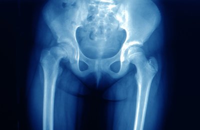 Paediatric Physiotherapy | Complete Physio