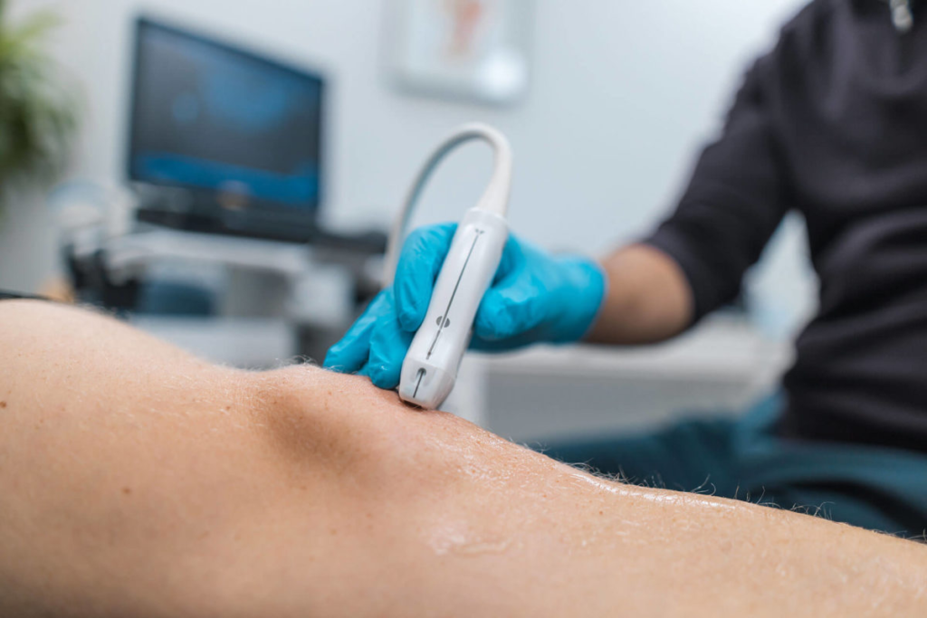 Iliotibial Band Syndrome (“Runner’s Knee”) | Complete Physio