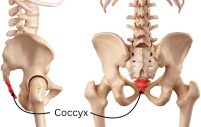 Coccyx Pain (Coccydynia) and Pelvic Health at Complete Physio