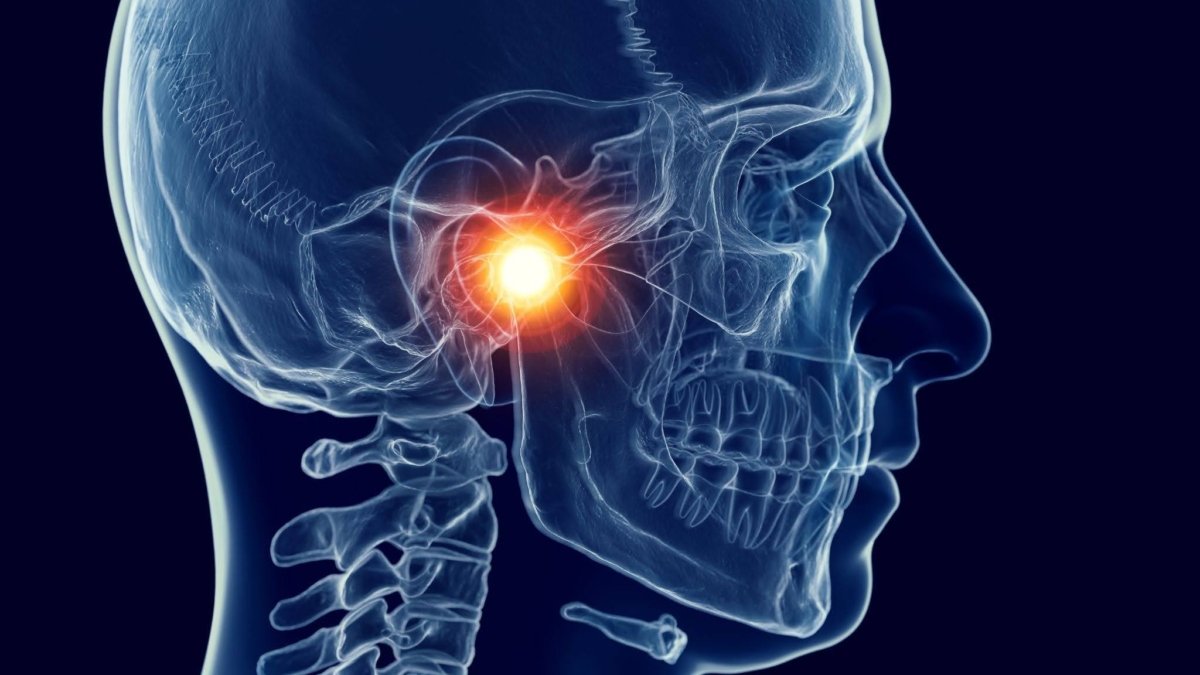 Temporomandibular Joint (TMJ) Dysfunction | Complete Physio